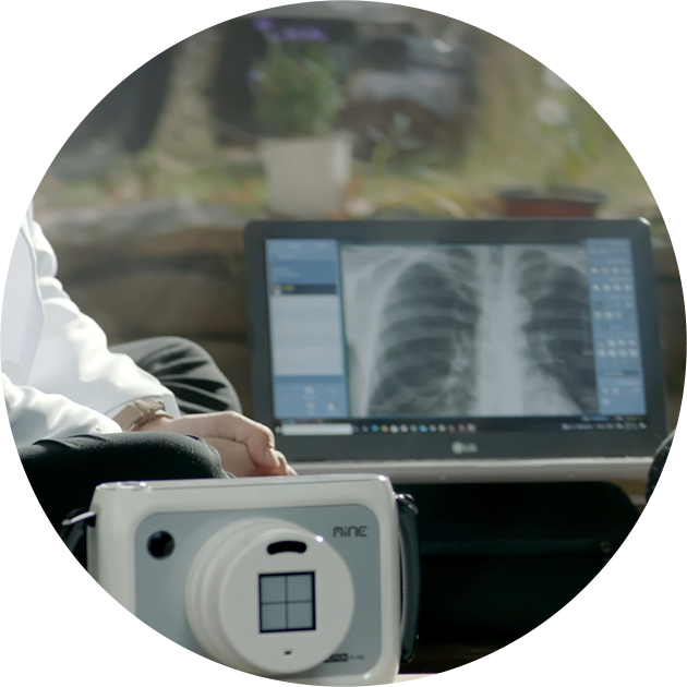 Portable X-ray Systems | Mine Alnu - Nooka & Rextar-X | Avittia